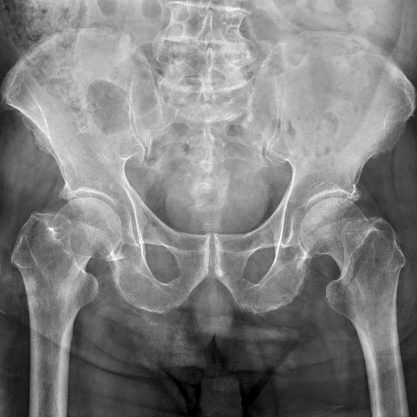 Xray Object Detection Dataset And Pre Trained Model By Testing