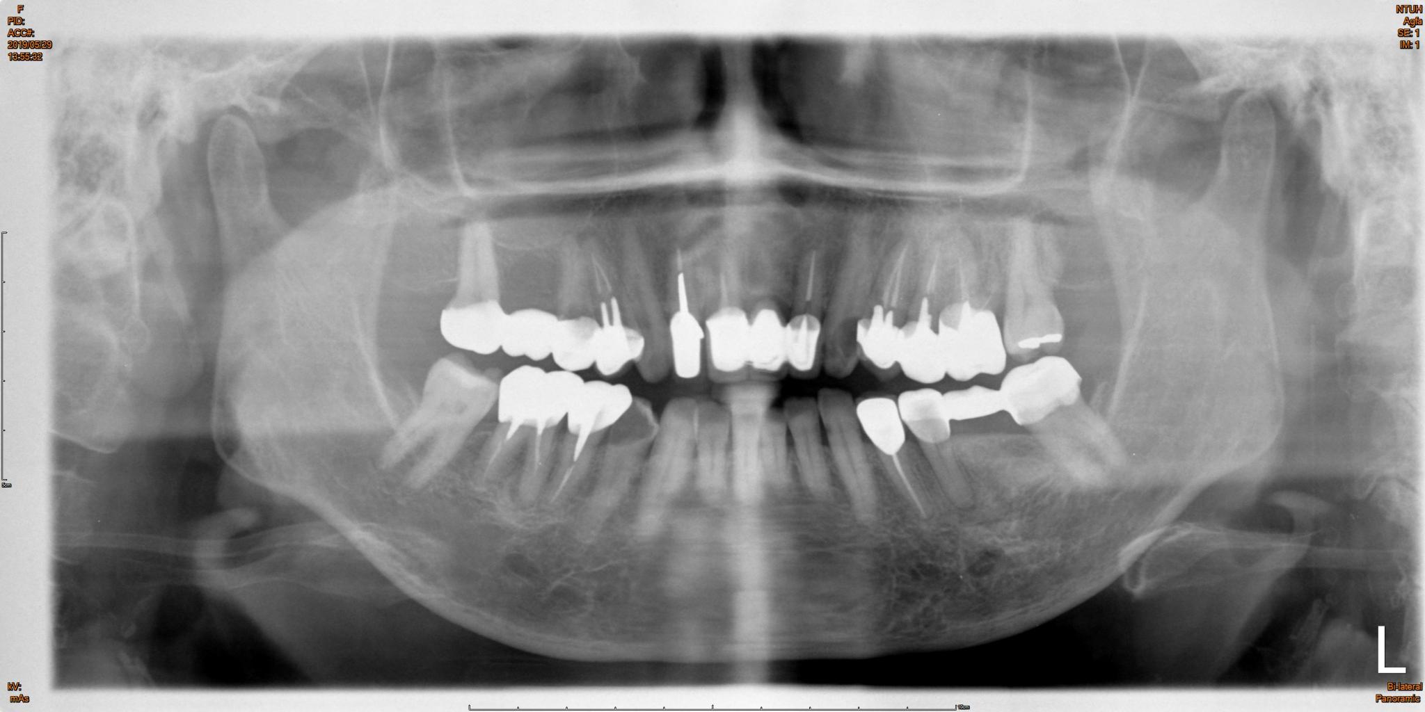 kaggle retain Object Detection Dataset by dentex