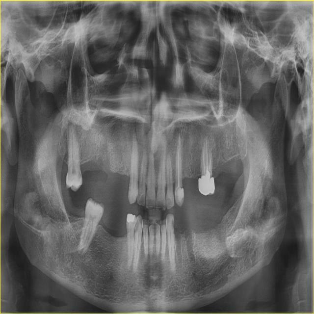 dentex (dentex-hhs9g) - Roboflow Universe