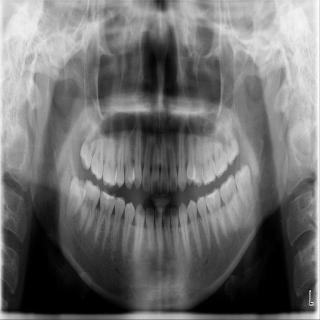 Arshs Workspace Roboflow Universe