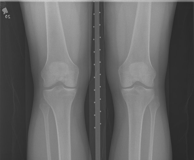 knee-joint-localization-all Object Detection Dataset by ... knee-joint-localization-all Object Detection Dataset by ...