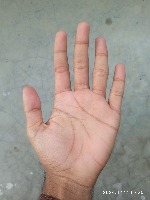 Palm Detection - Roboflow Universe