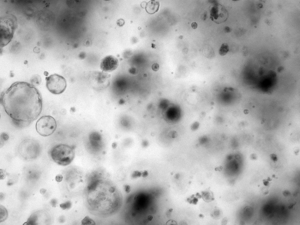 4X_V1+10X_V2_Merge Object Detection Dataset and Pre-Trained Model by CystFinder