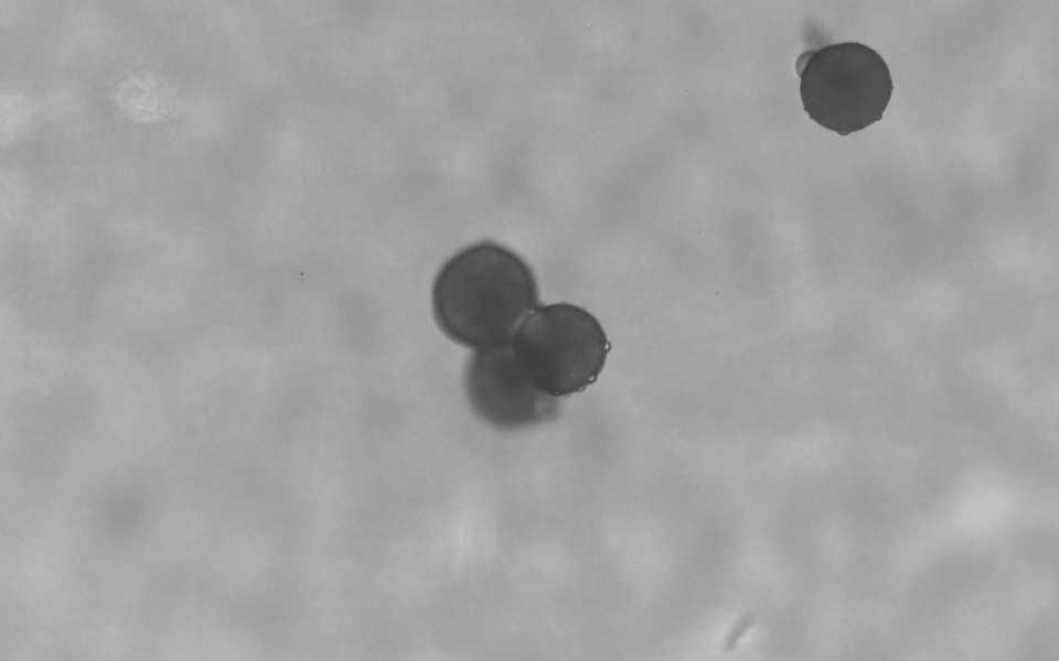 particle detection in clusters Object Detection Dataset by ... particle detection in clusters Object Detection Dataset by ...