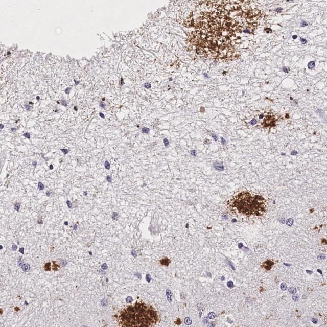 Plaque detection - Roboflow Universe