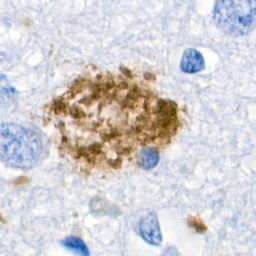 lab_3 Object Detection Dataset by Plaque detection