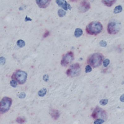 RNAscope_positive_cell_detection_ver4 Object Detection Dataset by YUSUKE KOMATSU