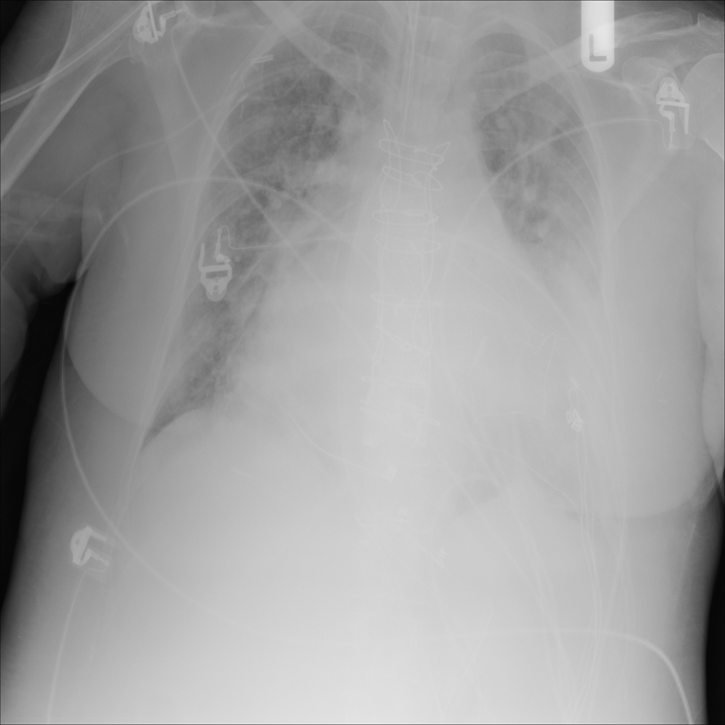 FOOD detection (food-detection-mbq7q) - Roboflow Universe