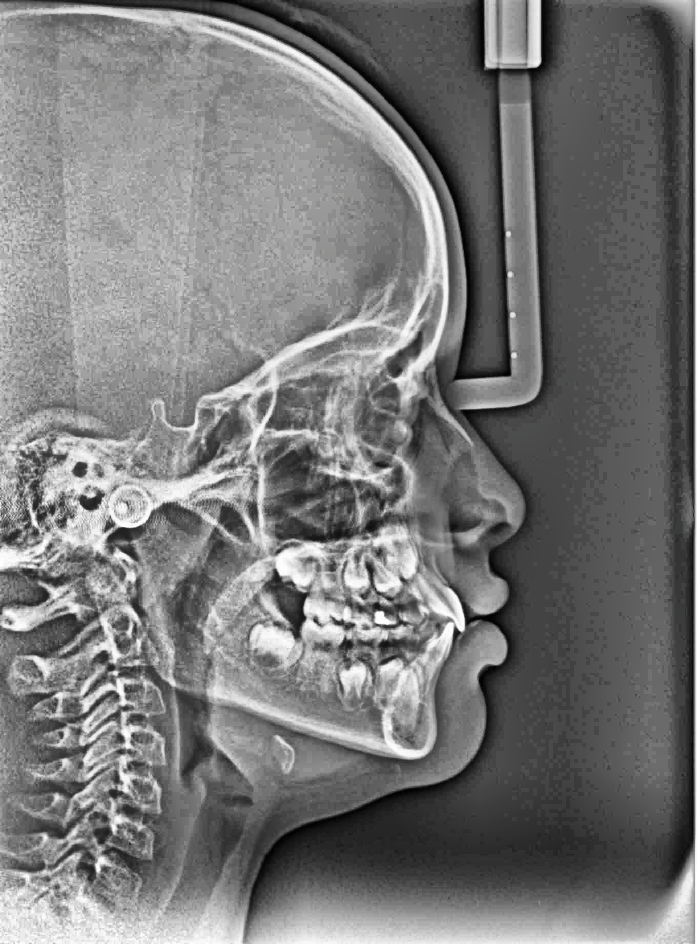 seg_100 Object Detection Dataset by seg