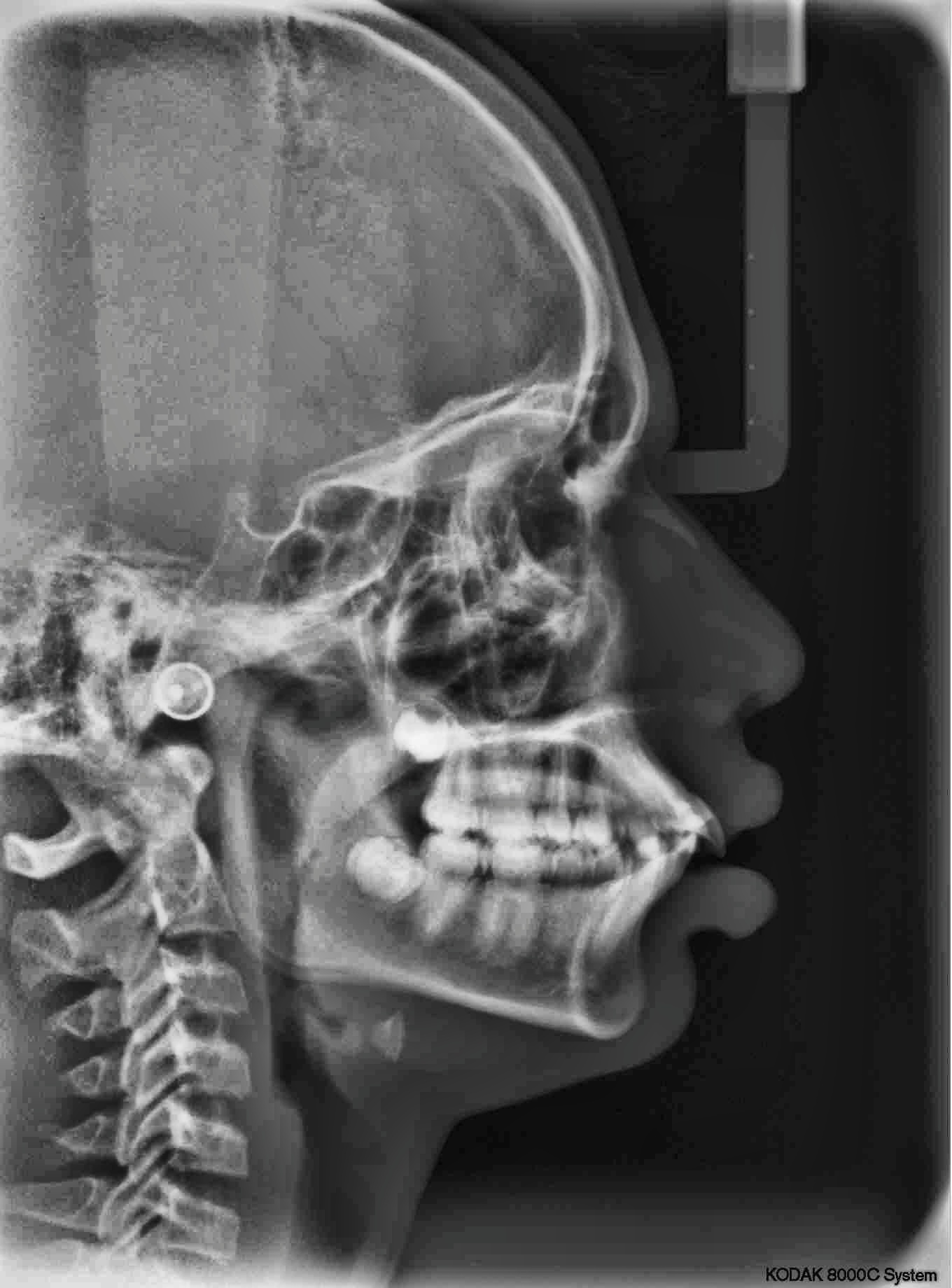 airway_seg Instance Segmentation Dataset by seg