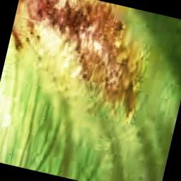 disease one Object Detection Dataset and Pre-Trained Model by detection project