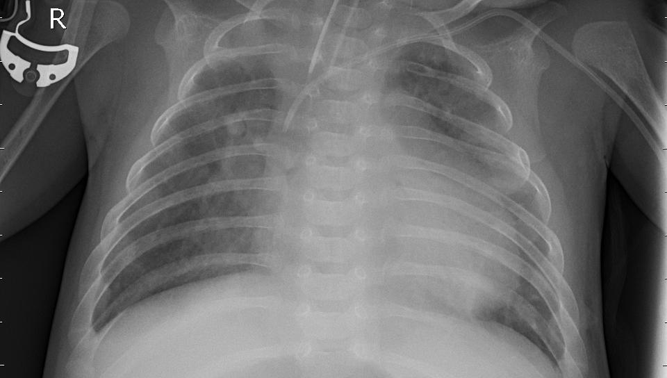 Medical X-rays / CT dataset Object Detection Dataset and Pre-Trained Model by MrAhmad Data ...