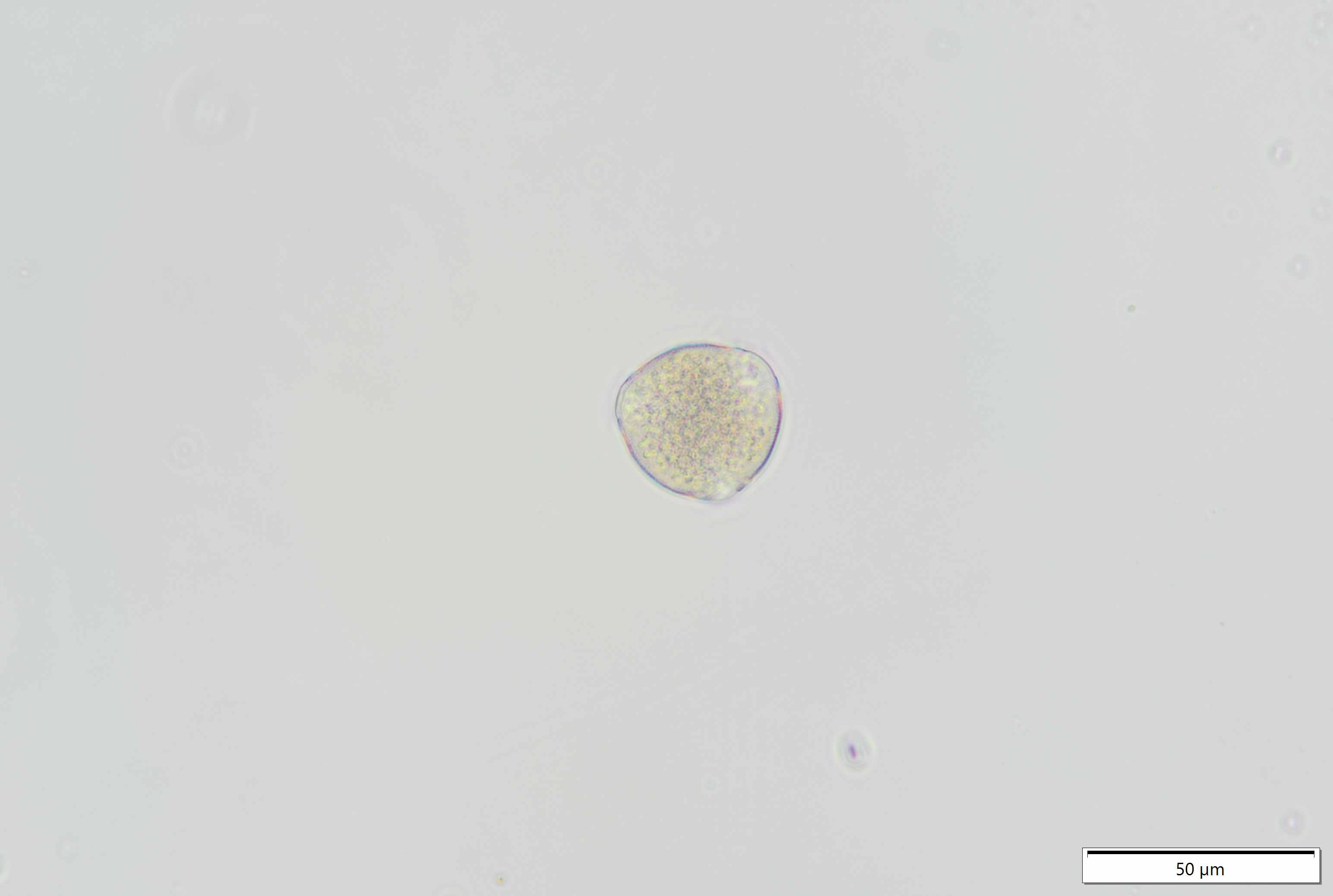 3 pollens Object Detection Dataset and Pre-Trained Model by pollen