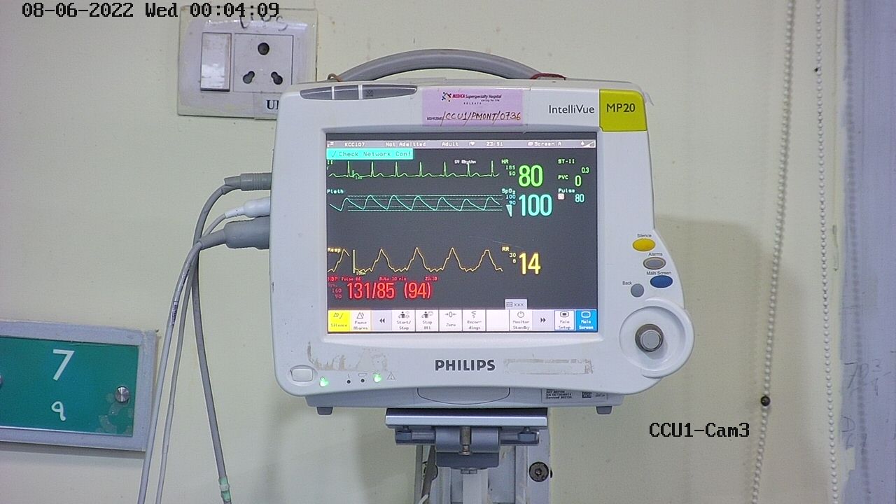ECG Instance Segmentation Dataset and Pre-Trained Model by Computer Vision