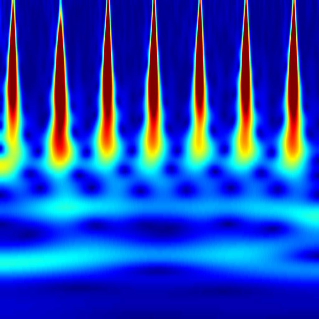 data Object Detection Model by ECG images