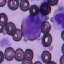 wbc-bounding-box Object Detection Model by SMack Lab