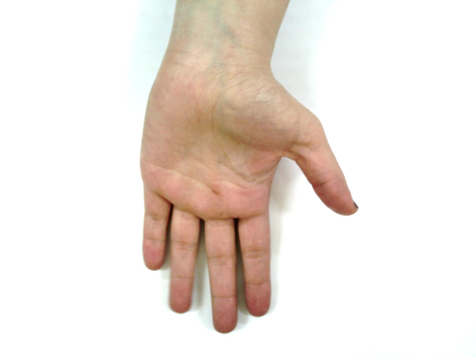 Palm Detection Object Detection Model By Handpay