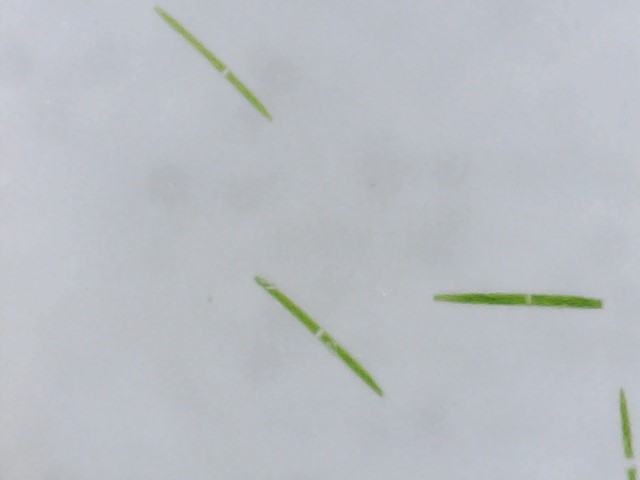 Algae_V1 Object Detection Dataset by new-workspace-gte7l