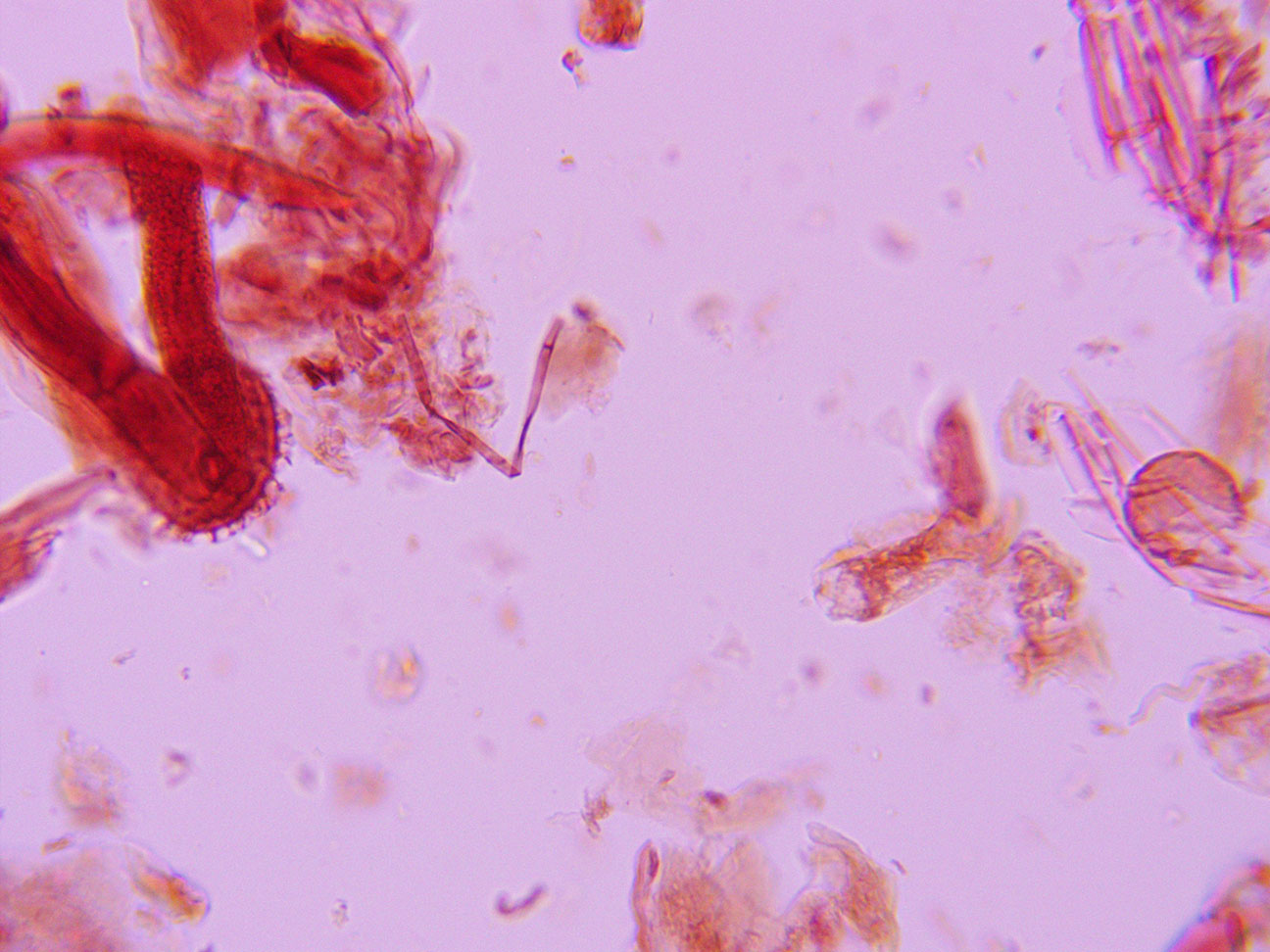 Uk Pollen Real World Benchmark Object Detection Dataset by Gill Hunt