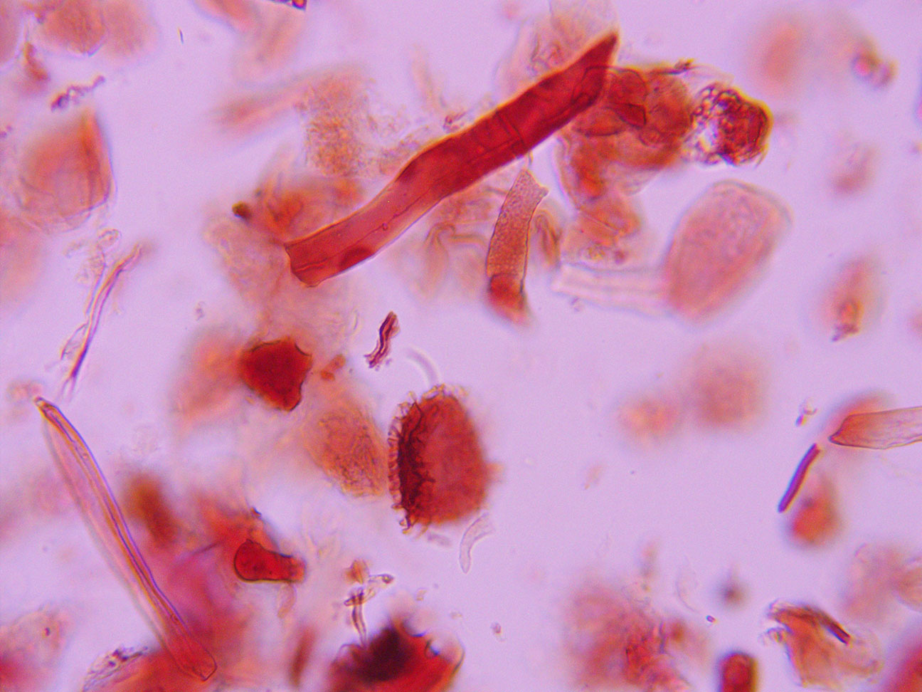 pollen Object Detection Dataset by Gill Hunt