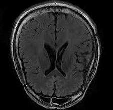 How to Use the yes tumor Object Detection API