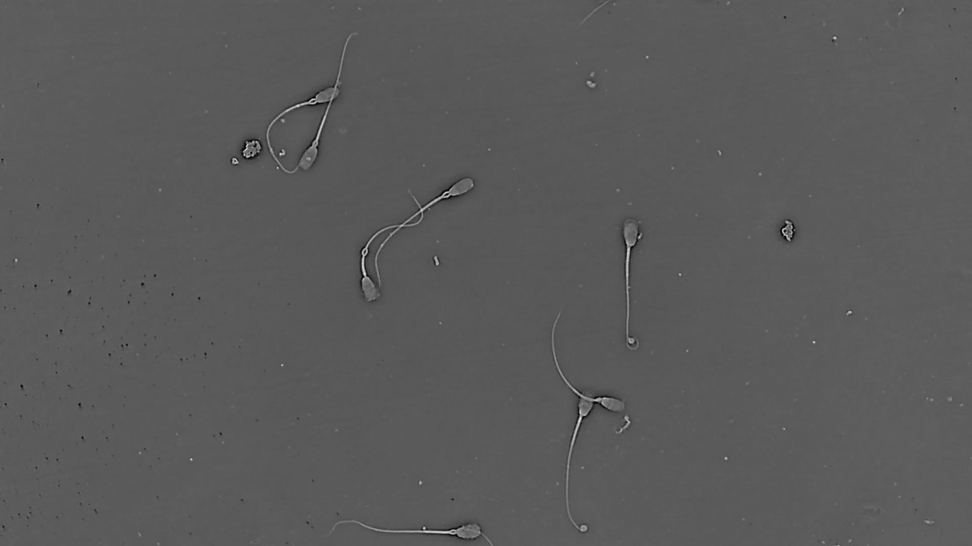 Bovine Sperm Cells Test Object Detection Dataset And Pre Trained Model By Boarspermmorphology