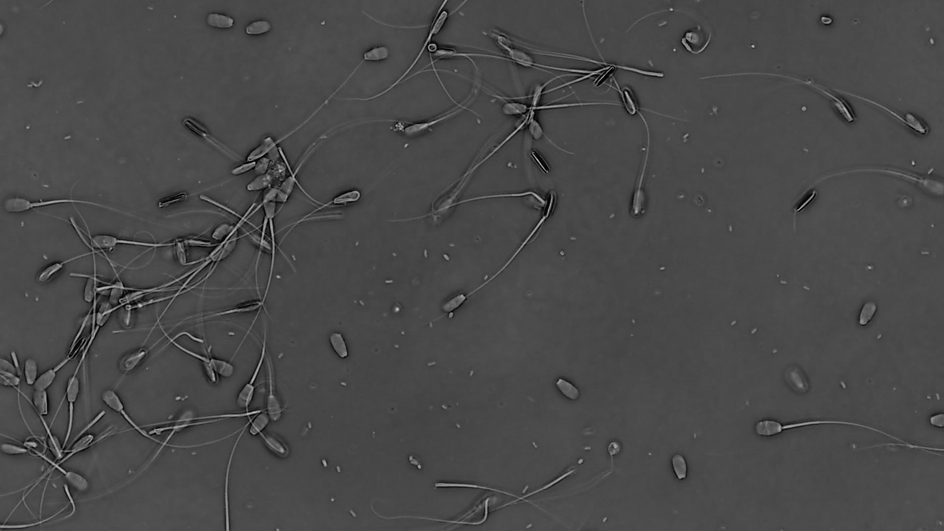 Bovine sperm cells test Object Detection Dataset and Pre-Trained Model ...