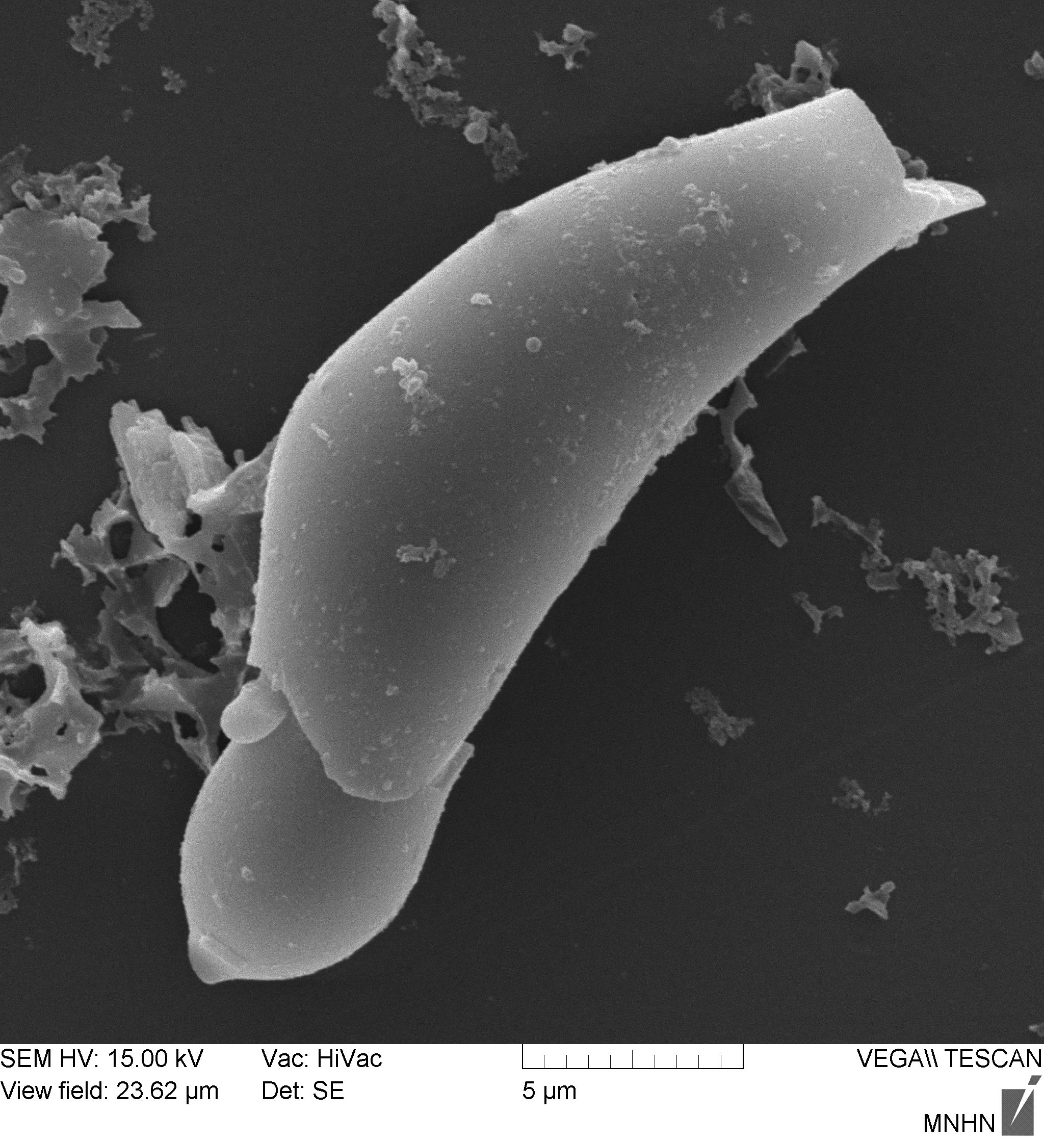 MICRO Object Detection Model by YOLOWN