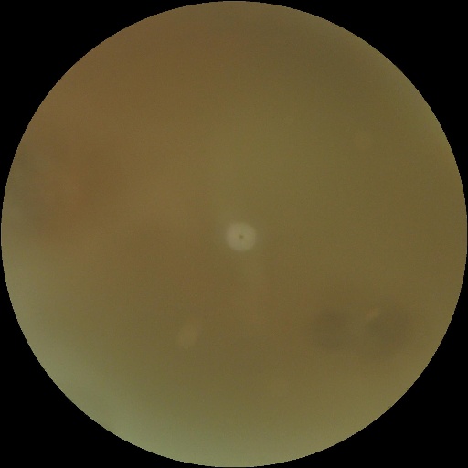 Retinal Disease Detection Classification Dataset And Pre Trained Model By Zihan