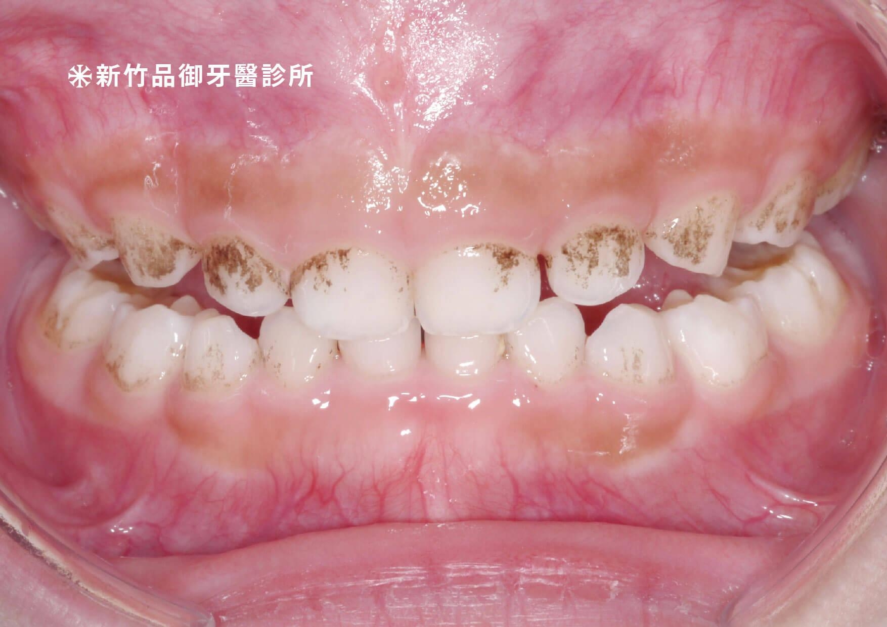 train-i4unu-qkluh-mdec Object Detection Dataset by Roboflow 100-VL