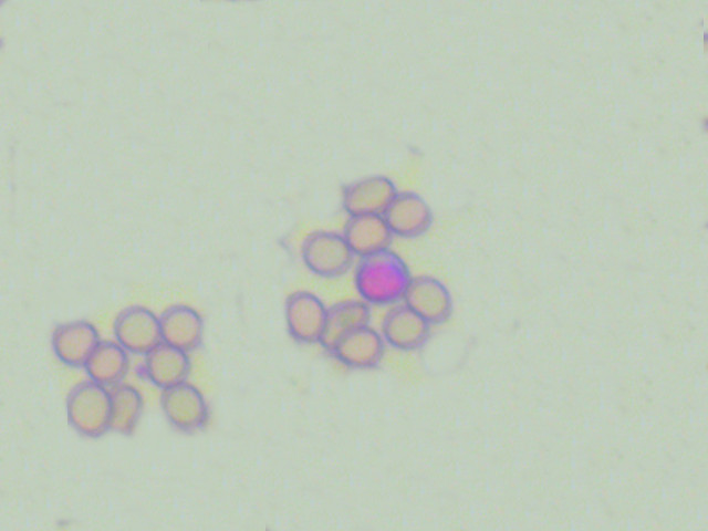 blood_cell_smear Object Detection Dataset by doodle