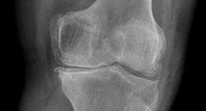 How to Use the yolov5 Object Detection API