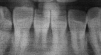 BOUNDING BOX Object Detection Model by BioMET