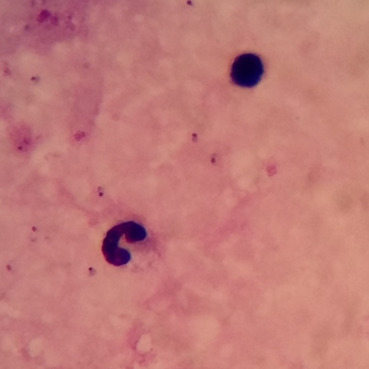 Malaria Object Detection Model by dental project