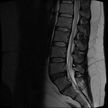 Train MRI Instance Segmentation Model by MyWorkspace