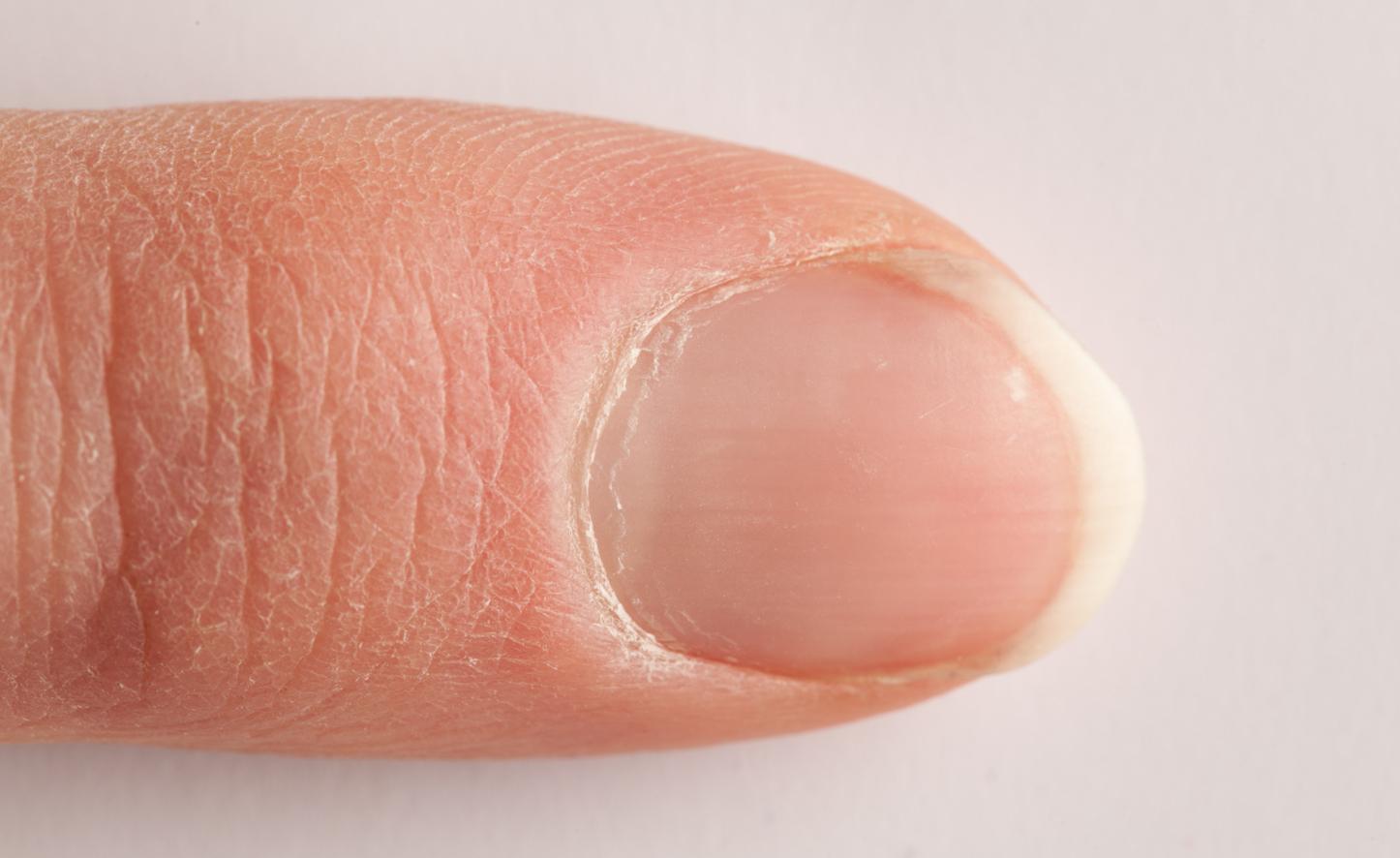 nail Object Detection Dataset by NTNU