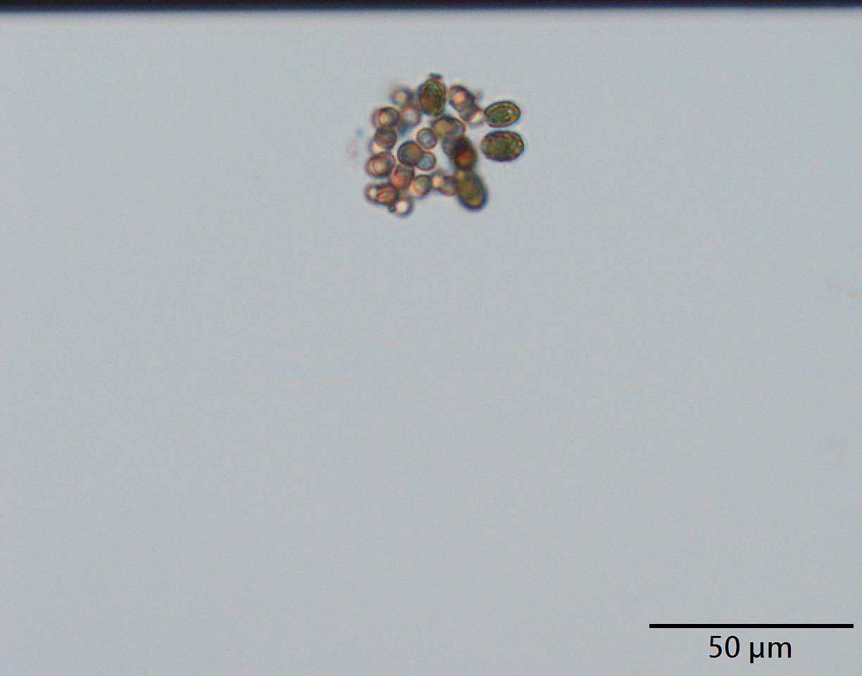Counting cells Object Detection Model by Counting cells