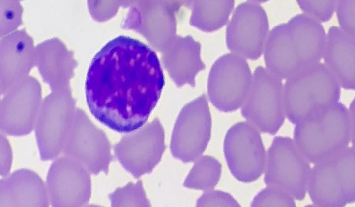 wbc Object Detection Dataset by Mitja