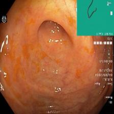 revita-novianti - Roboflow Universe