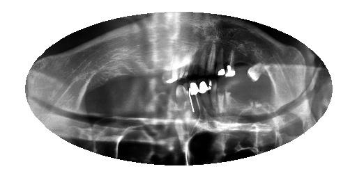 Teeth Object Detection Dataset By Teethdetection