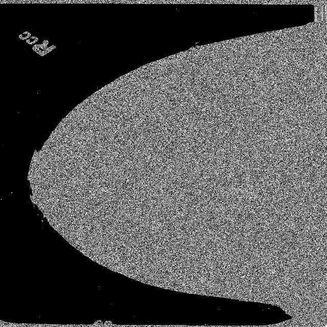 Bc Tumor Localization Object Detection Dataset By Ilham Elaalami