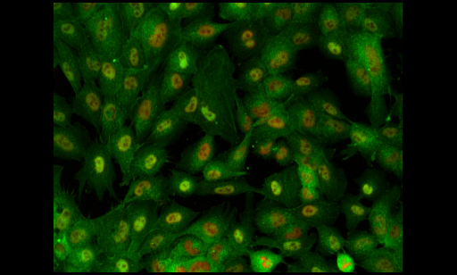 Cell Instance Segmentation Dataset And Pre Trained Model By Bibek