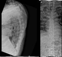 OVCF - Roboflow Universe