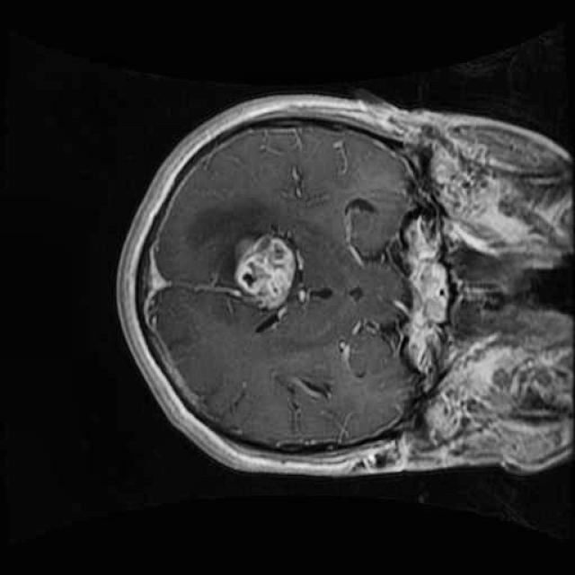 brain_instance Instance Segmentation Dataset by tanGoku