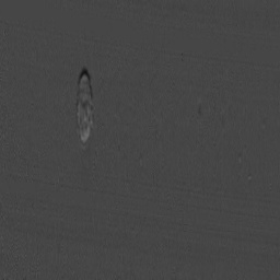 new malaria Object Detection Model by Malaria