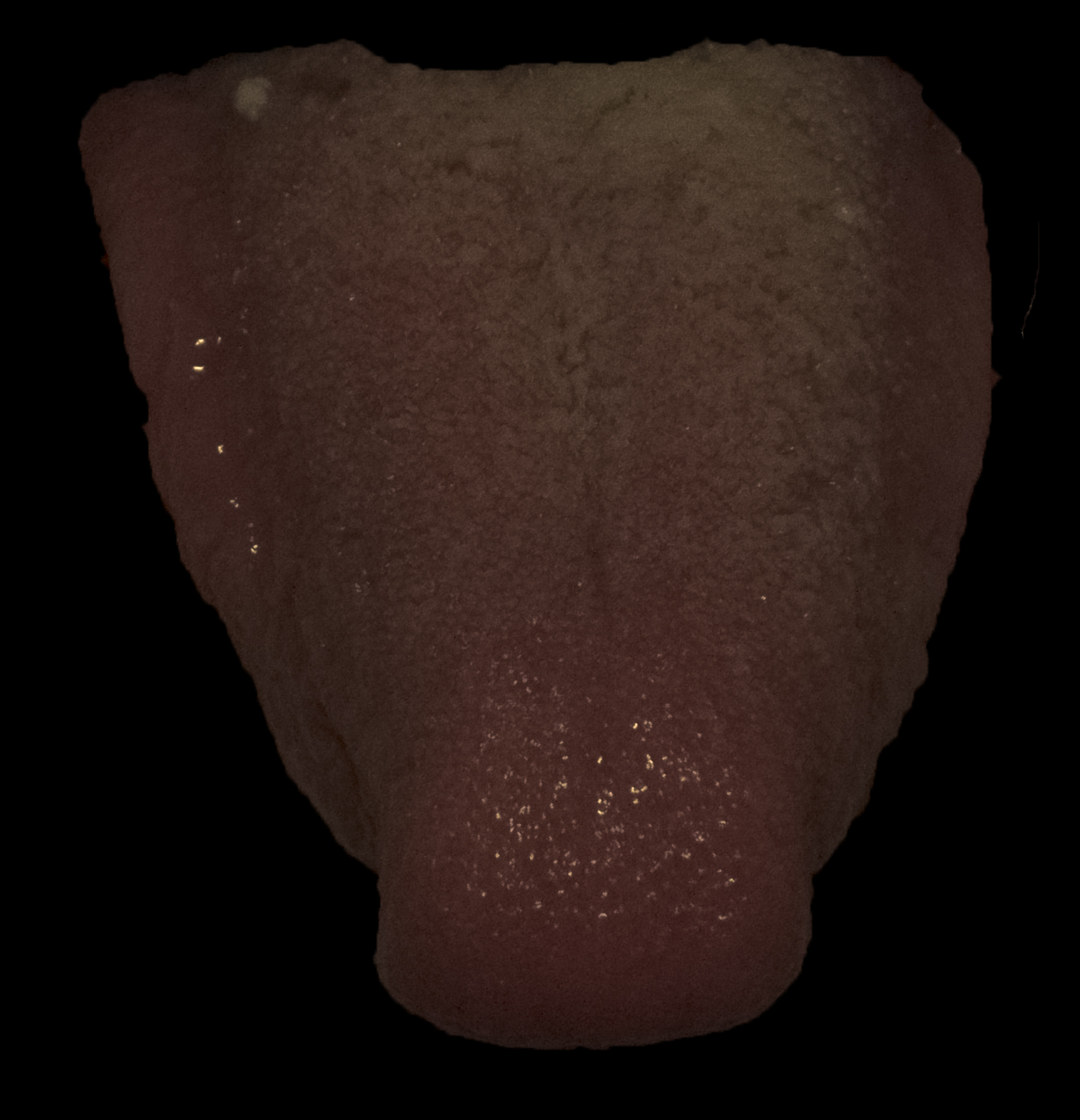 tongue Classification Model by Panchkarma