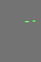 Eye Detector - Roboflow Universe