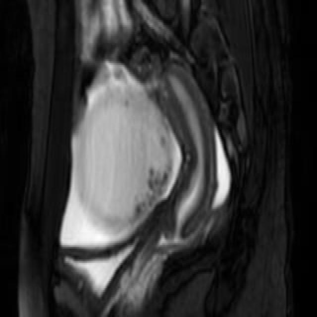 Ec Mri Dataset Object Detection Dataset By Ecmri
