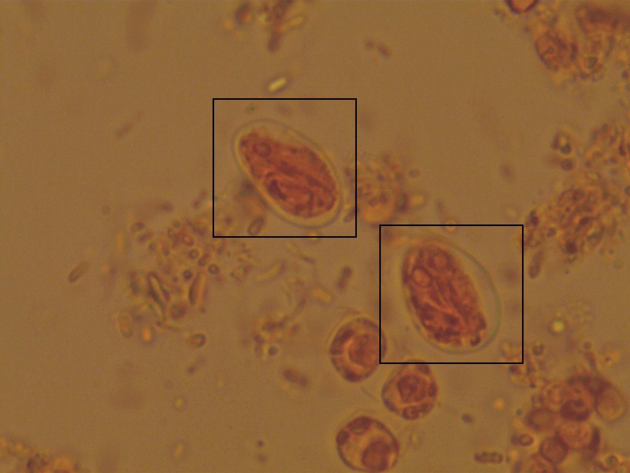 parasite Object Detection Dataset by FLAIRDataset