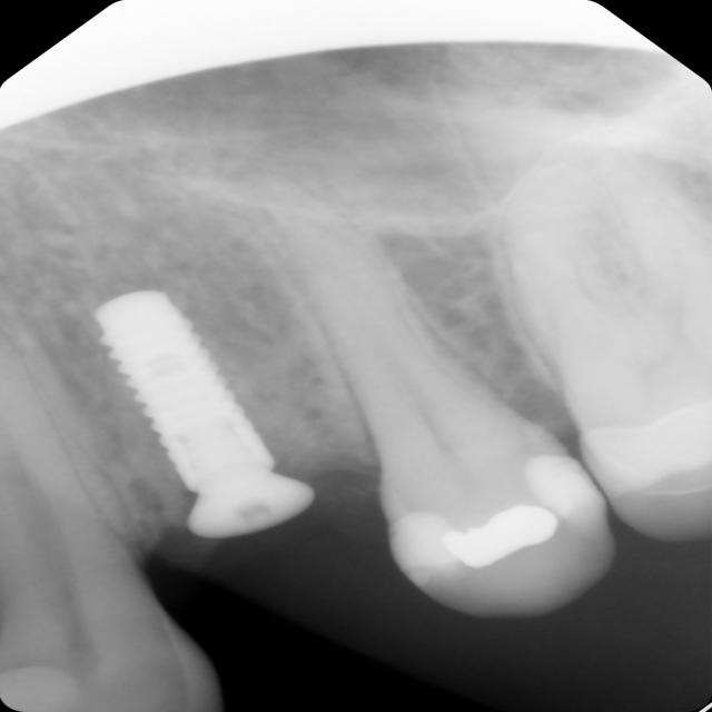 Keypoint Detection Keypoint Detection Dataset And Pre Trained Model By Zaanalizuzubi